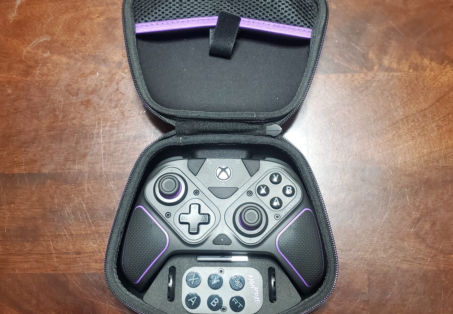 Xbox Victrix Pro BFG review — Simply the best